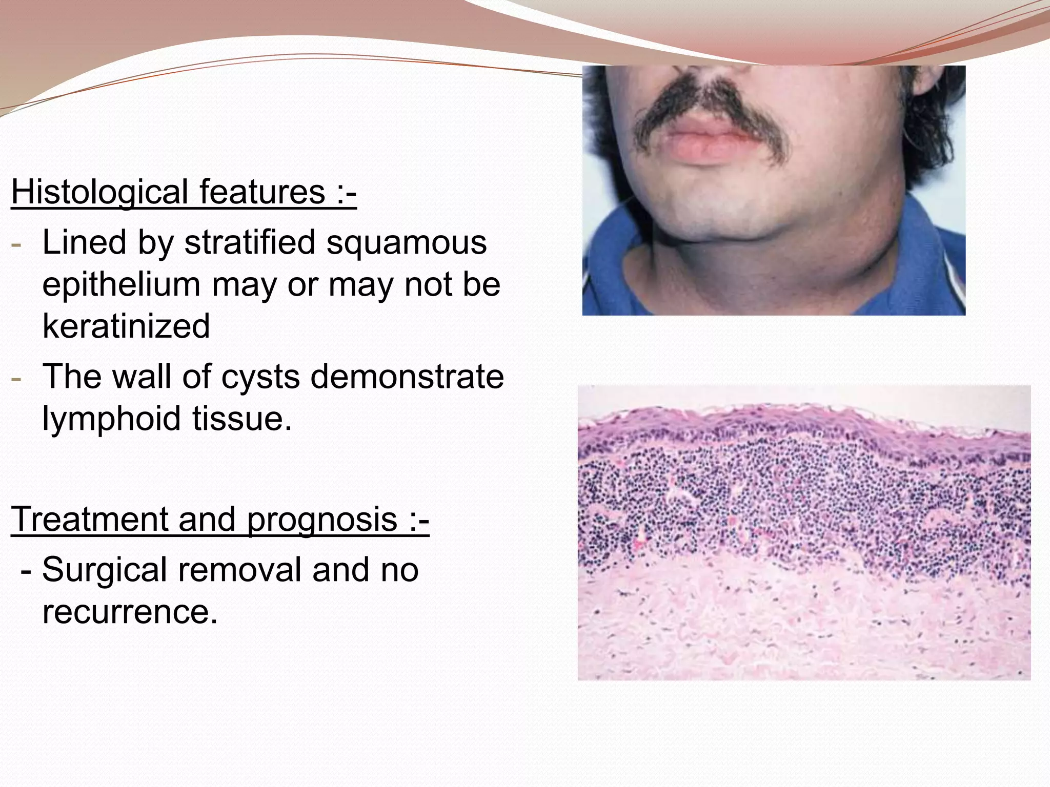 Developmental cysts.pptx