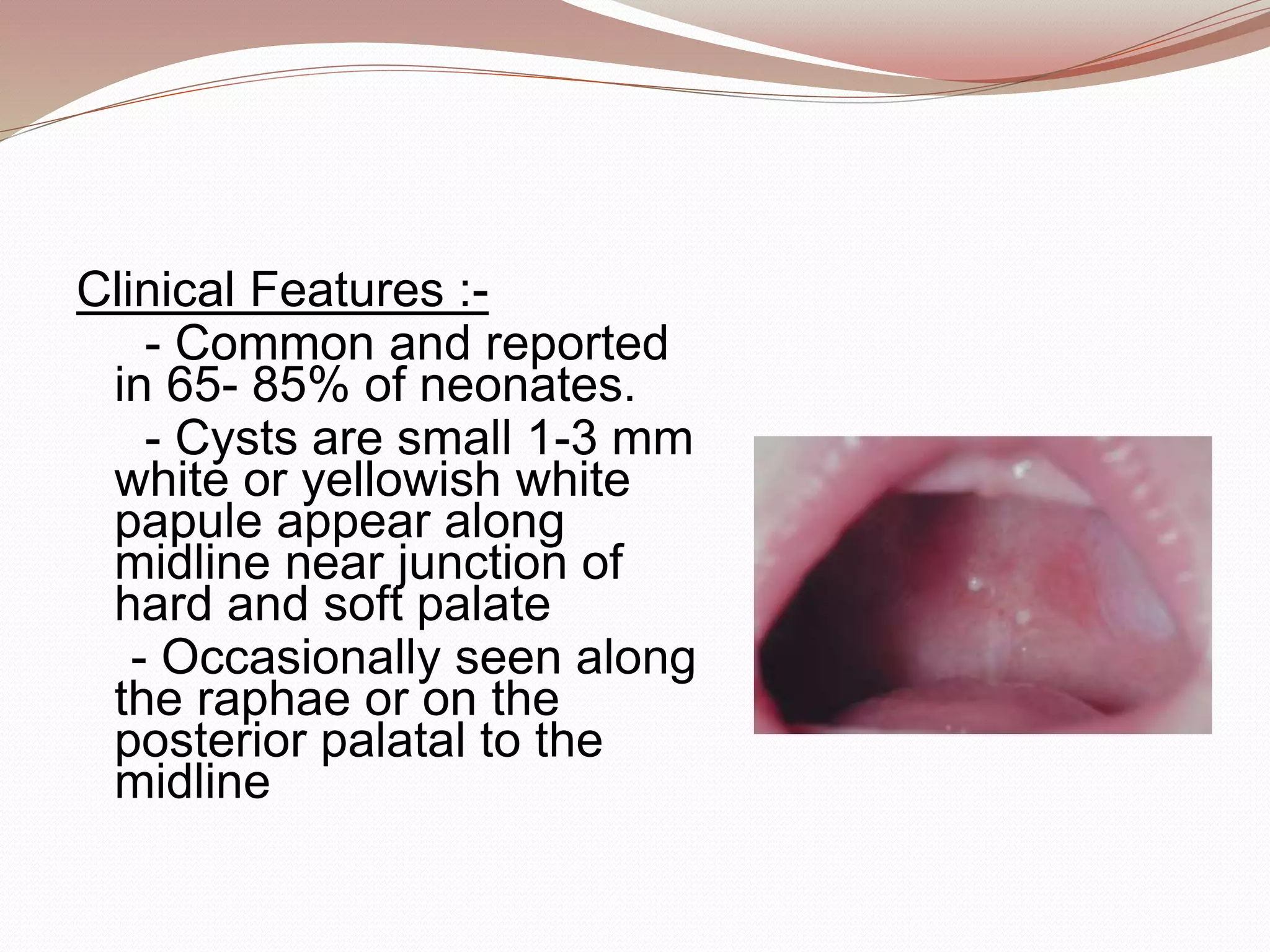Developmental cysts.pptx
