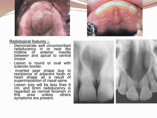 Developmental cysts.pptx