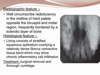 Developmental cysts.pptx