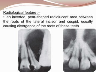 Developmental cysts.pptx