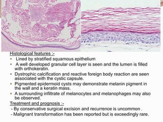 Developmental cysts.pptx