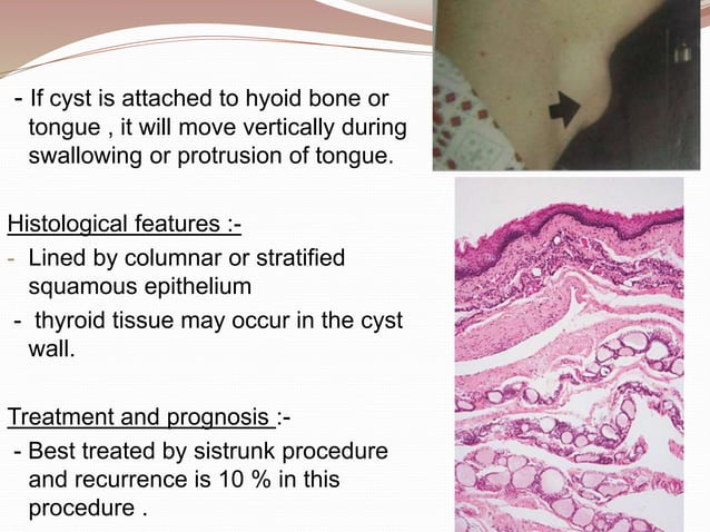 Developmental cysts.pptx | Ear, Nose and Throat Conditions | Diseases ...