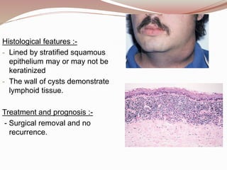 Developmental cysts.pptx
