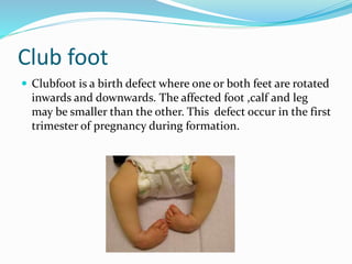 Developmental defects | PPTX