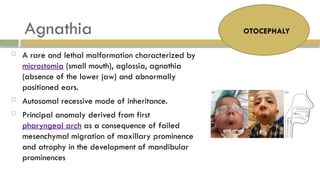 DEVELOPMENTAL DEFECTS AND MANAGEMENT IN PEDIATRIC DENTISTRY.pptx