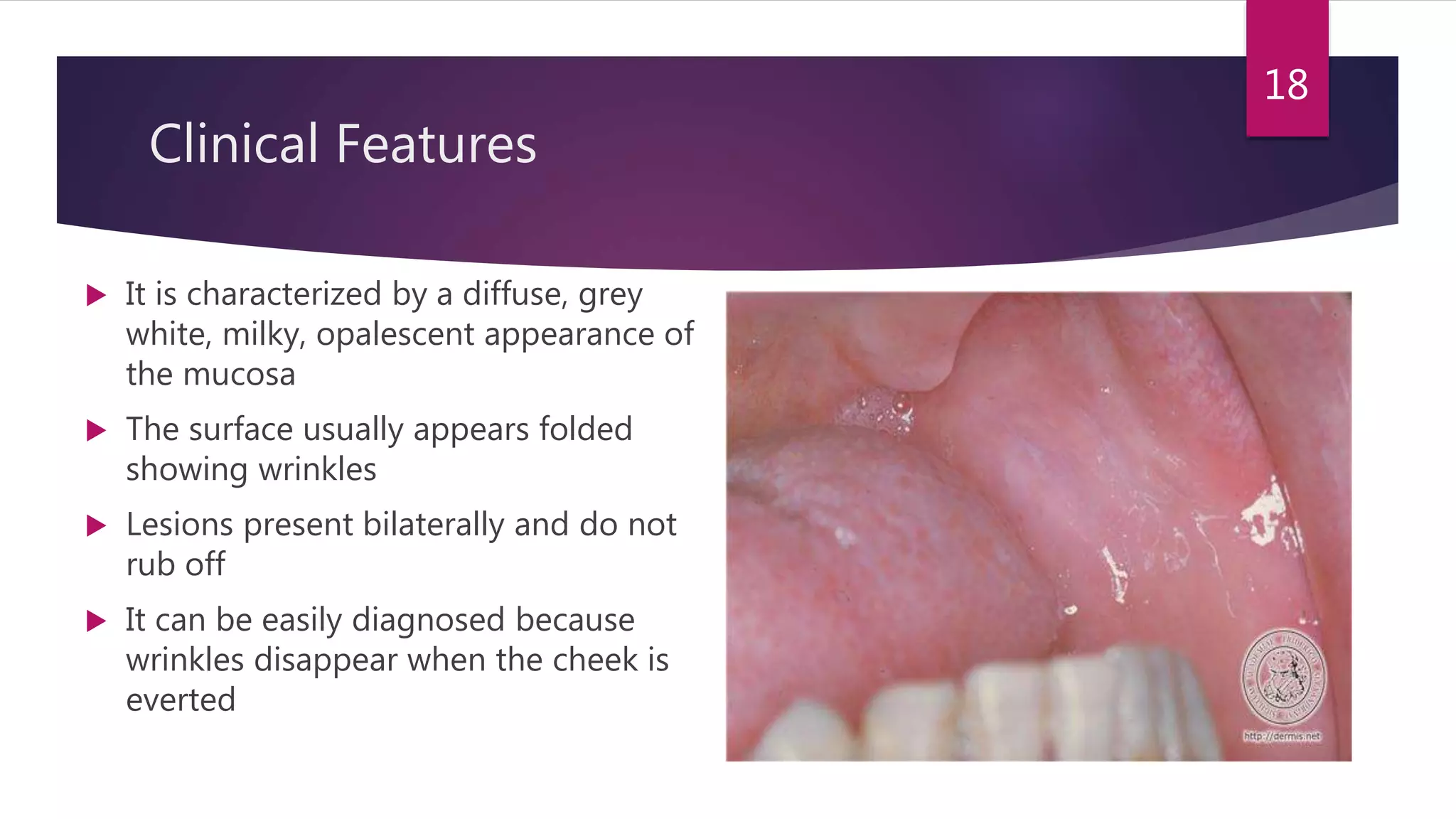 Developmental defects of oral & maxillofacial region | PPTX