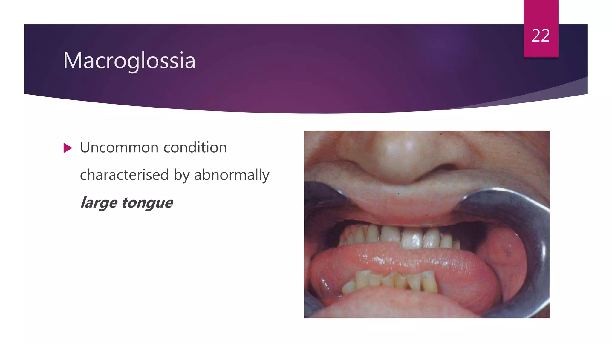 Developmental defects of oral & maxillofacial region | PPTX