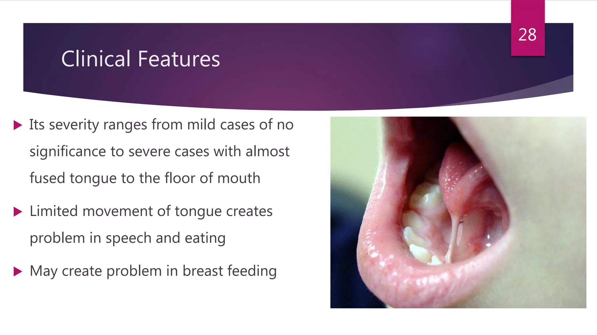 Developmental defects of oral & maxillofacial region | PPTX
