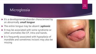 Developmental defects of oral & maxillofacial region | PPTX