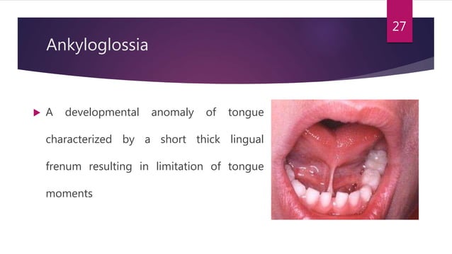 Developmental defects of oral & maxillofacial region | PPTX | Dental ...