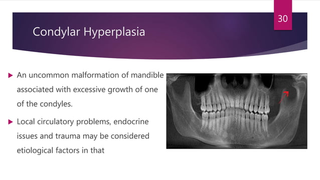 Developmental defects of oral & maxillofacial region | PPTX | Dental ...