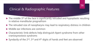 Developmental defects of oral & maxillofacial region | PPTX