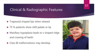 Developmental defects of oral & maxillofacial region | PPTX