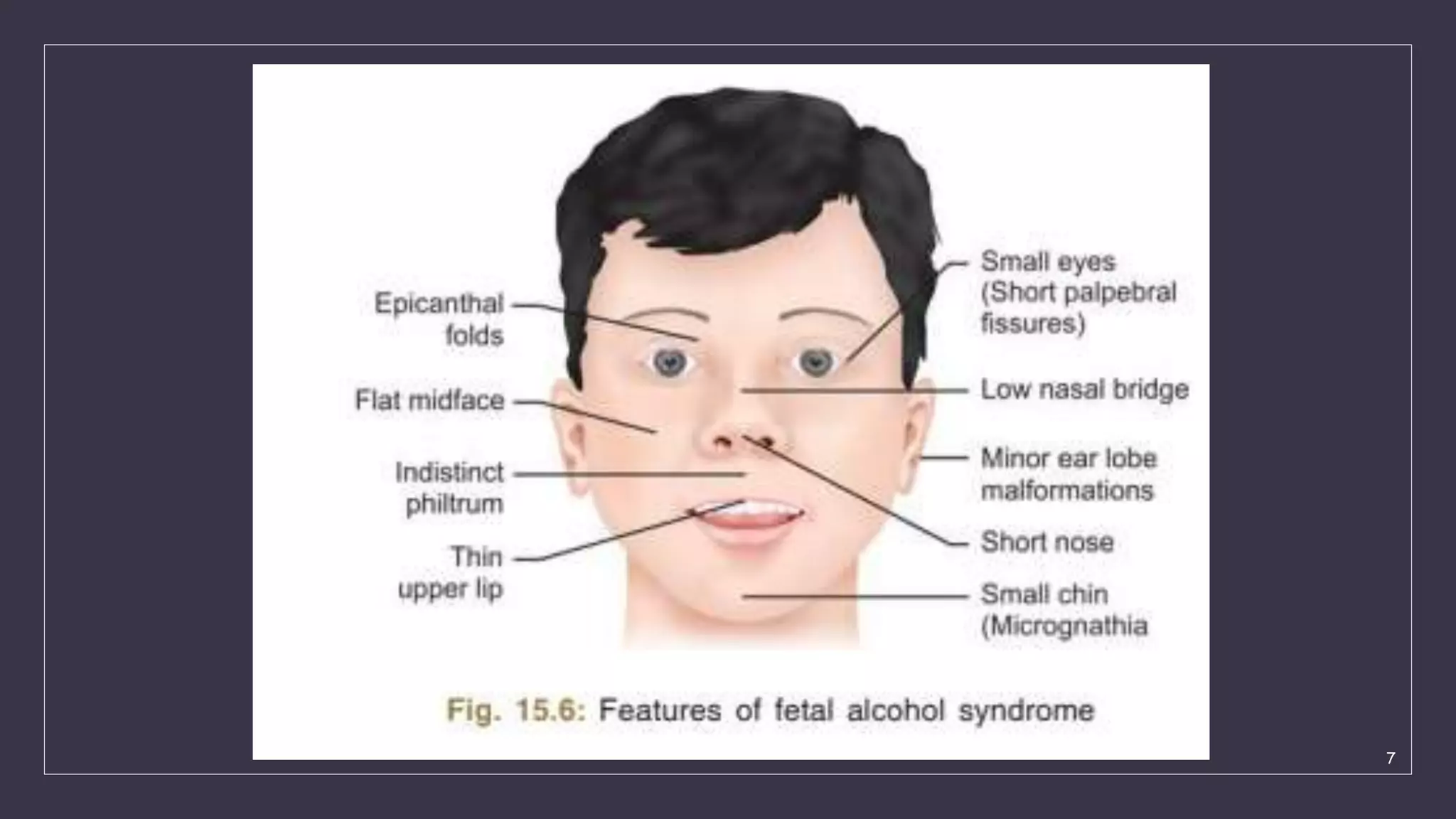 Developmental Defects Of Orofacial Structures | PPTX