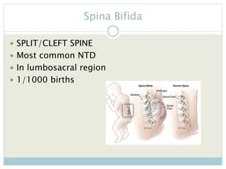 Developmental disease of spinal cord | PPTX