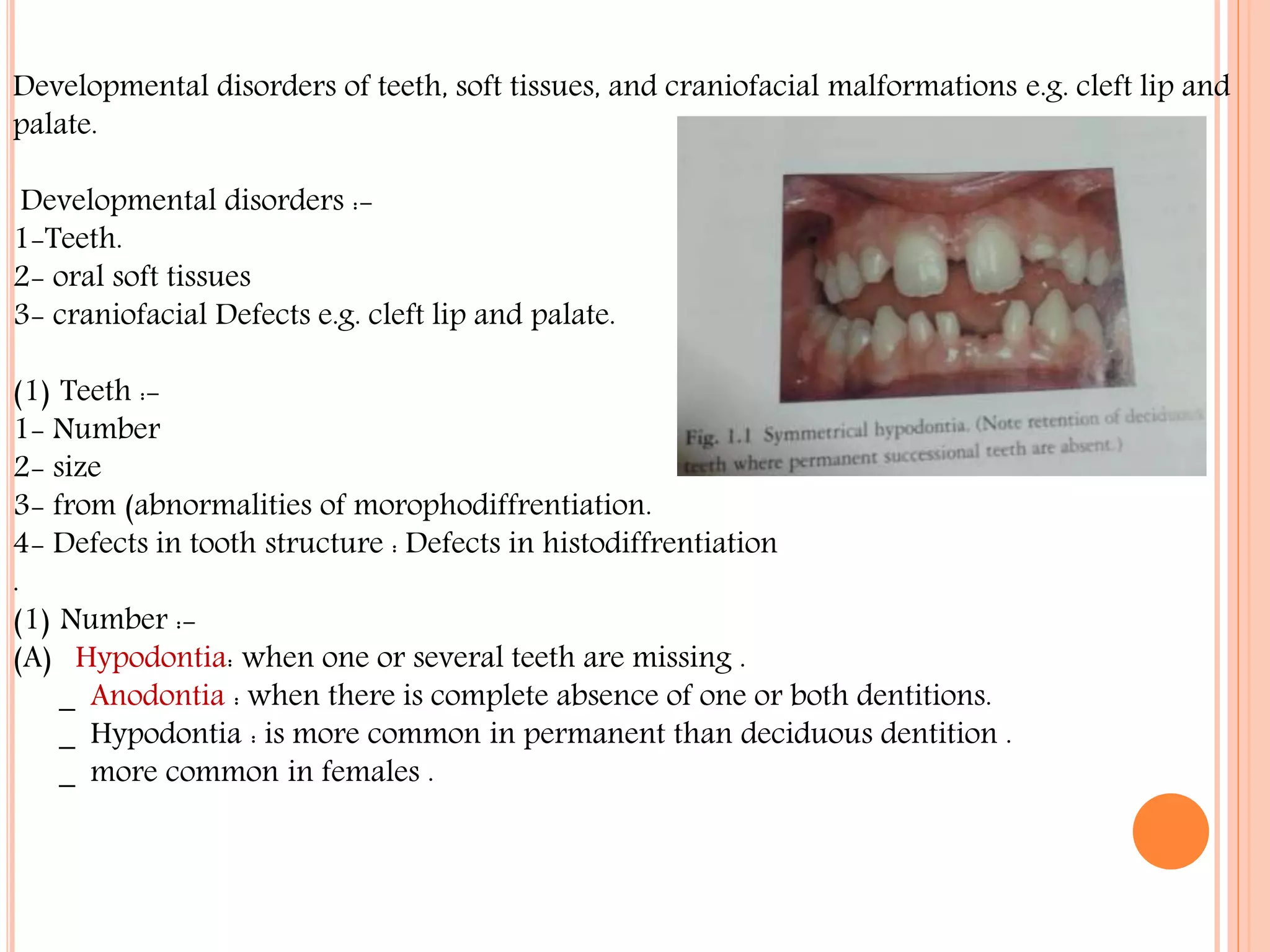 Oral Pathology - Developmental disorders of teeth and craniofacial ...
