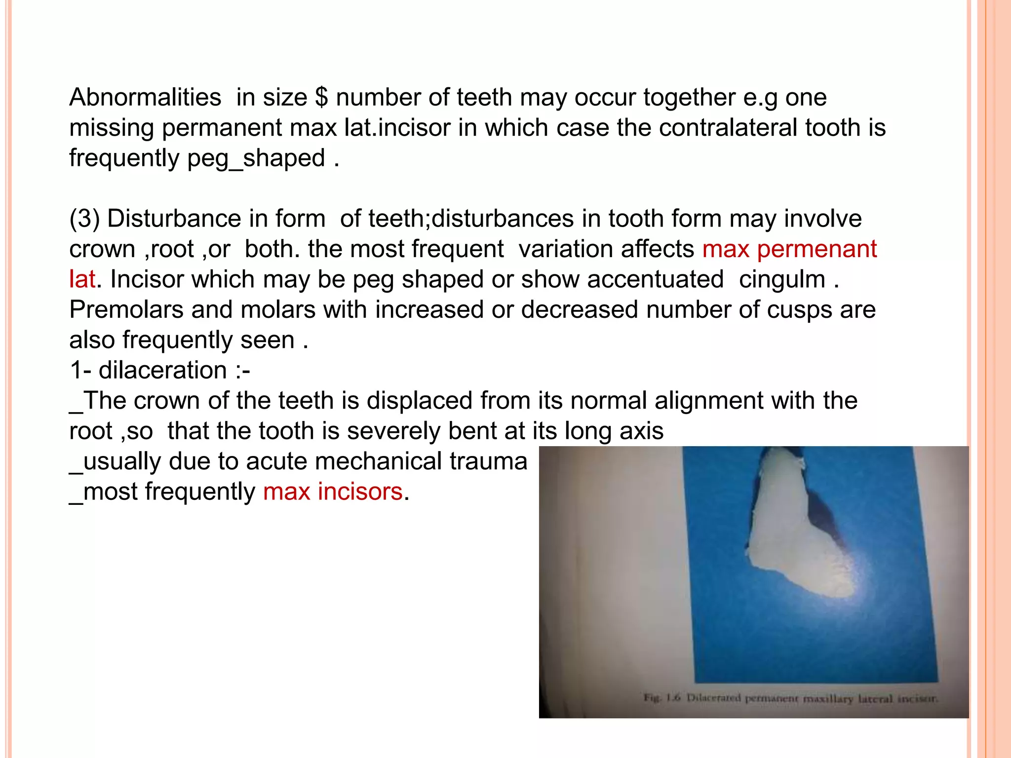 Oral Pathology - Developmental disorders of teeth and craniofacial ...