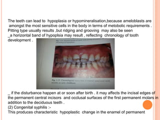 Oral Pathology - Developmental disorders of teeth and craniofacial ...