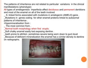 Oral Pathology - Developmental disorders of teeth and craniofacial ...