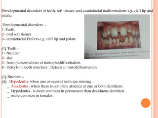Oral Pathology - Developmental disorders of teeth and craniofacial ...