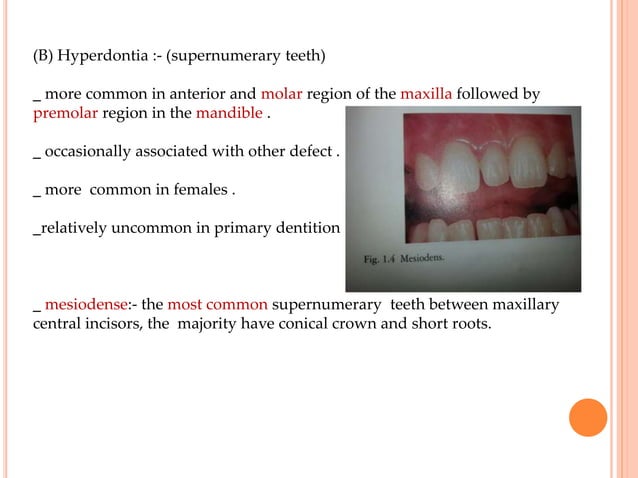 Oral Pathology - Developmental disorders of teeth and craniofacial ...