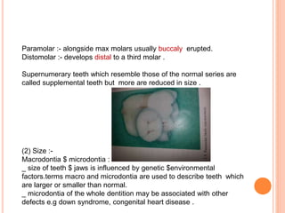 Oral Pathology - Developmental disorders of teeth and craniofacial ...