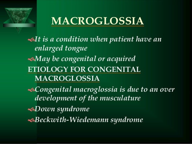 Developmental disorders of tongue elvis chiramel david