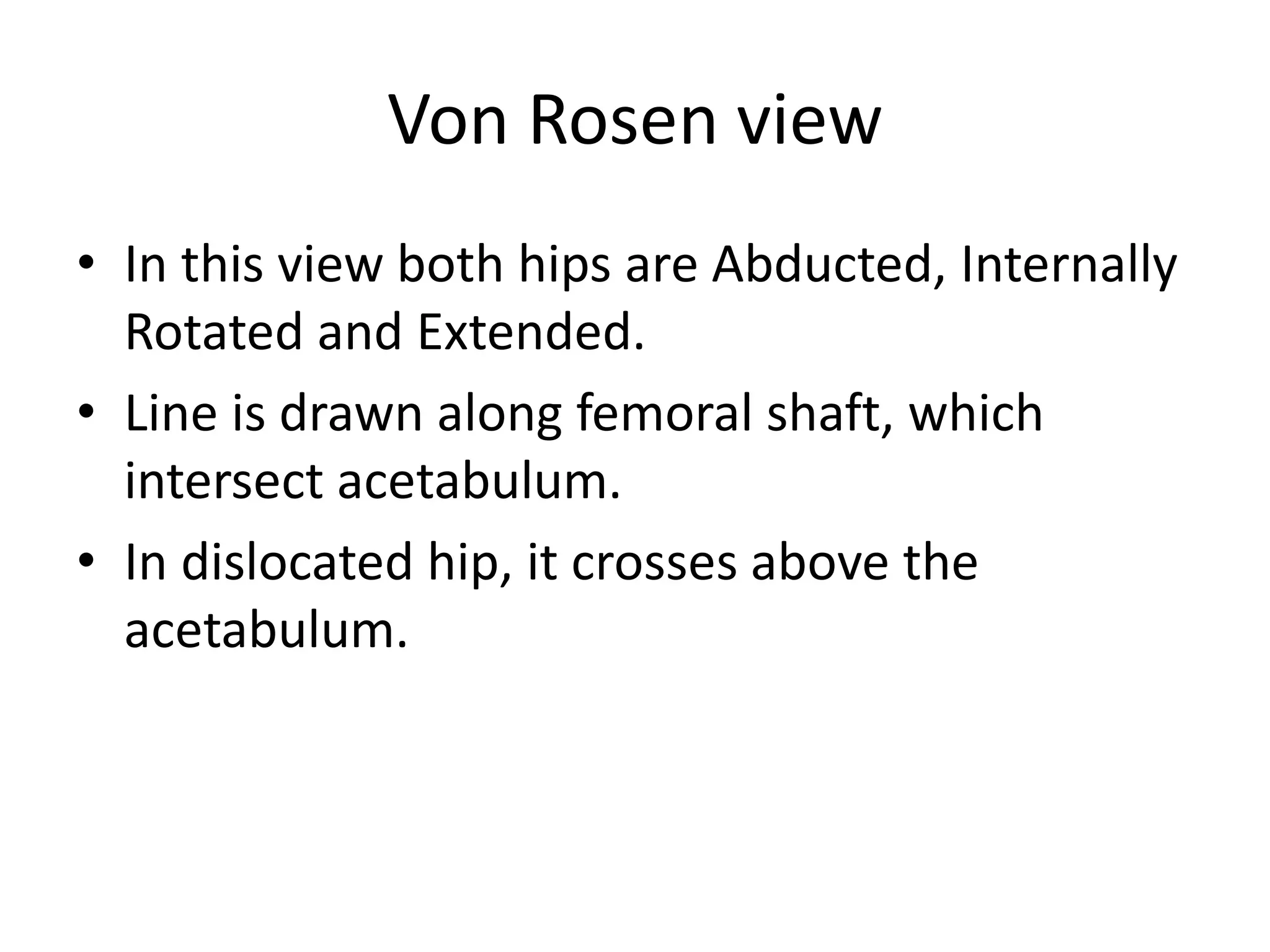 Developmental displasia of hip | PPTX