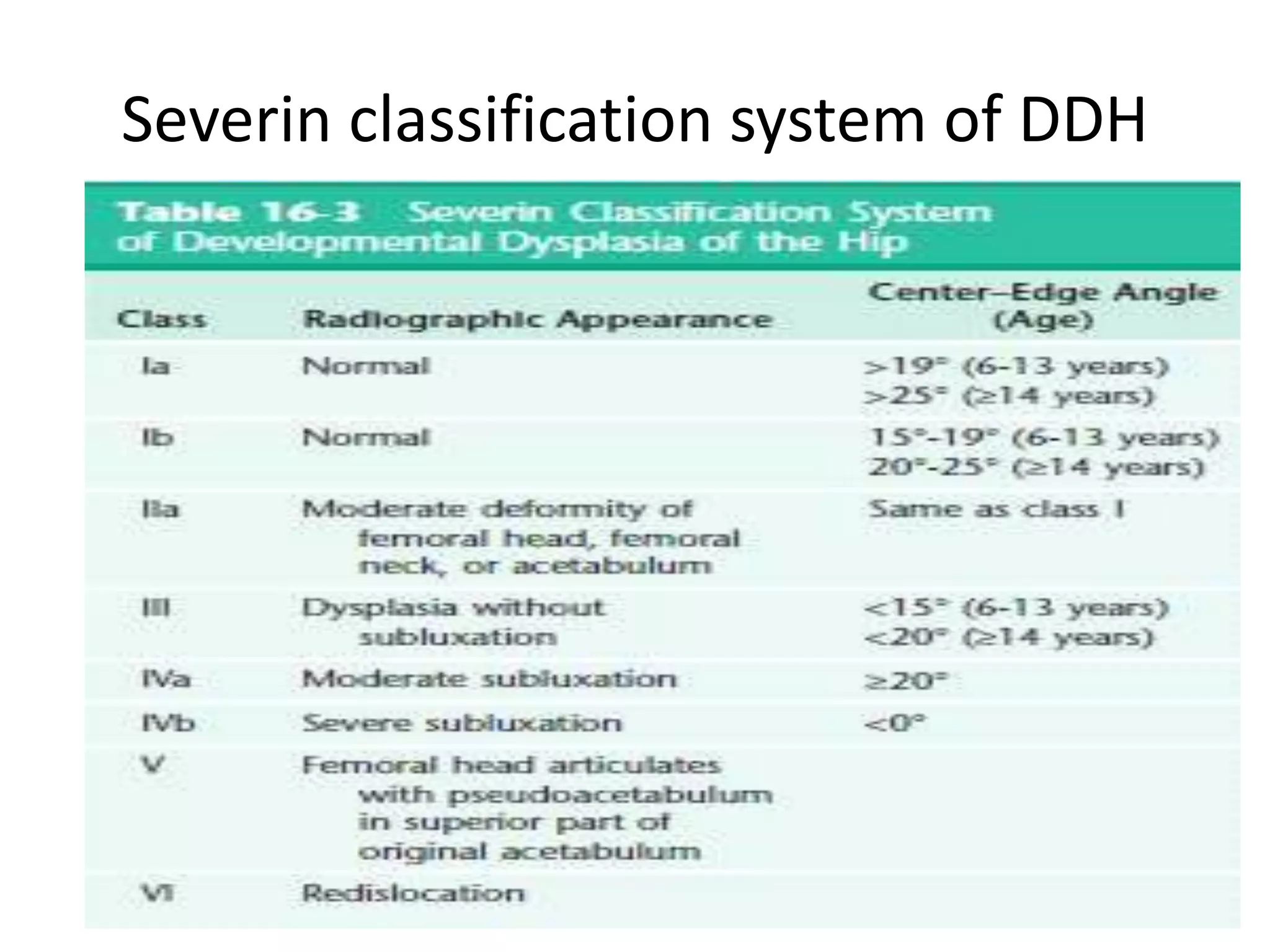 Developmental displasia of hip | PPTX