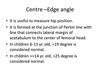 Developmental displasia of hip | PPTX