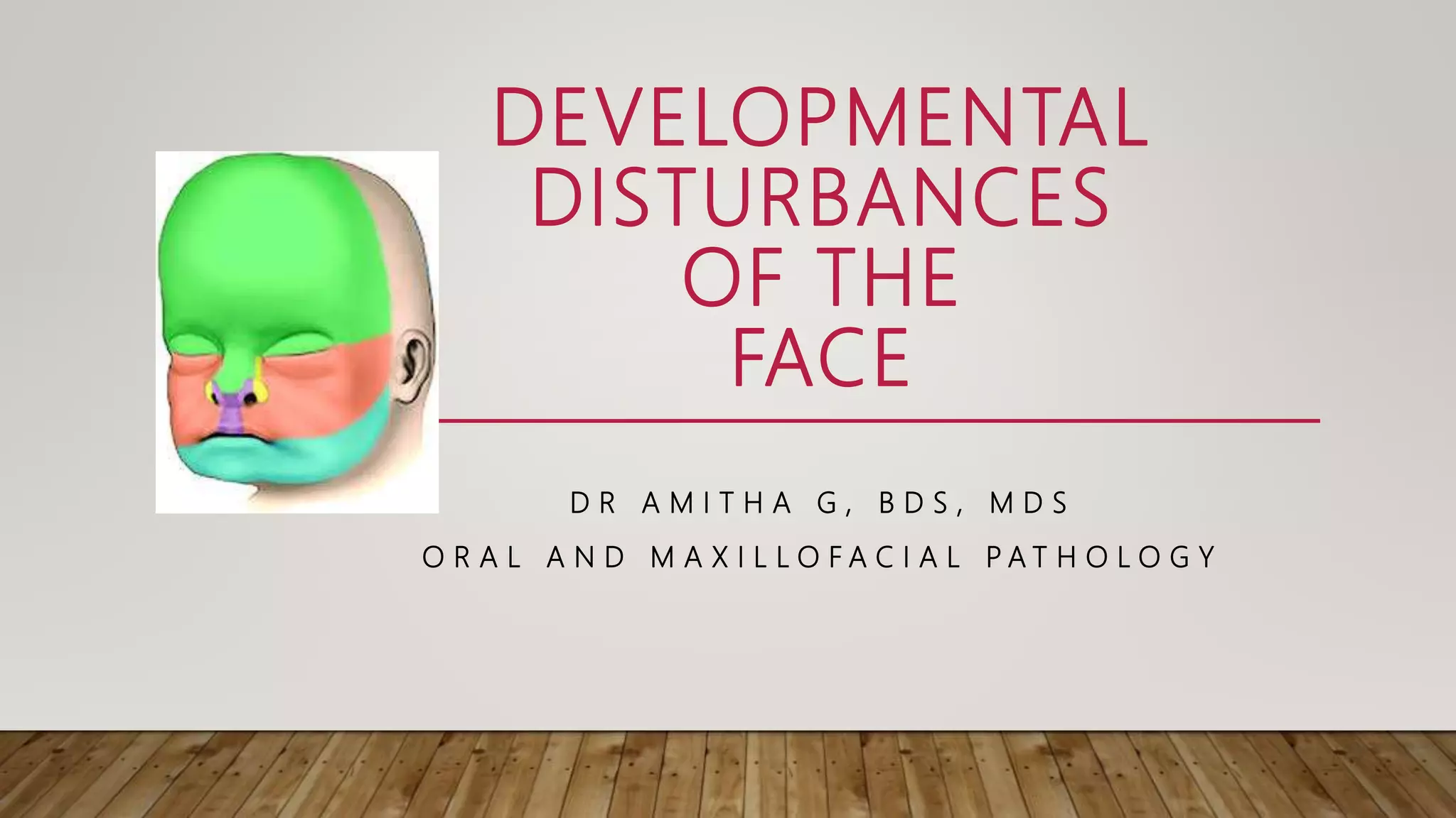 Developmental Disturbances of The Face | PPTX