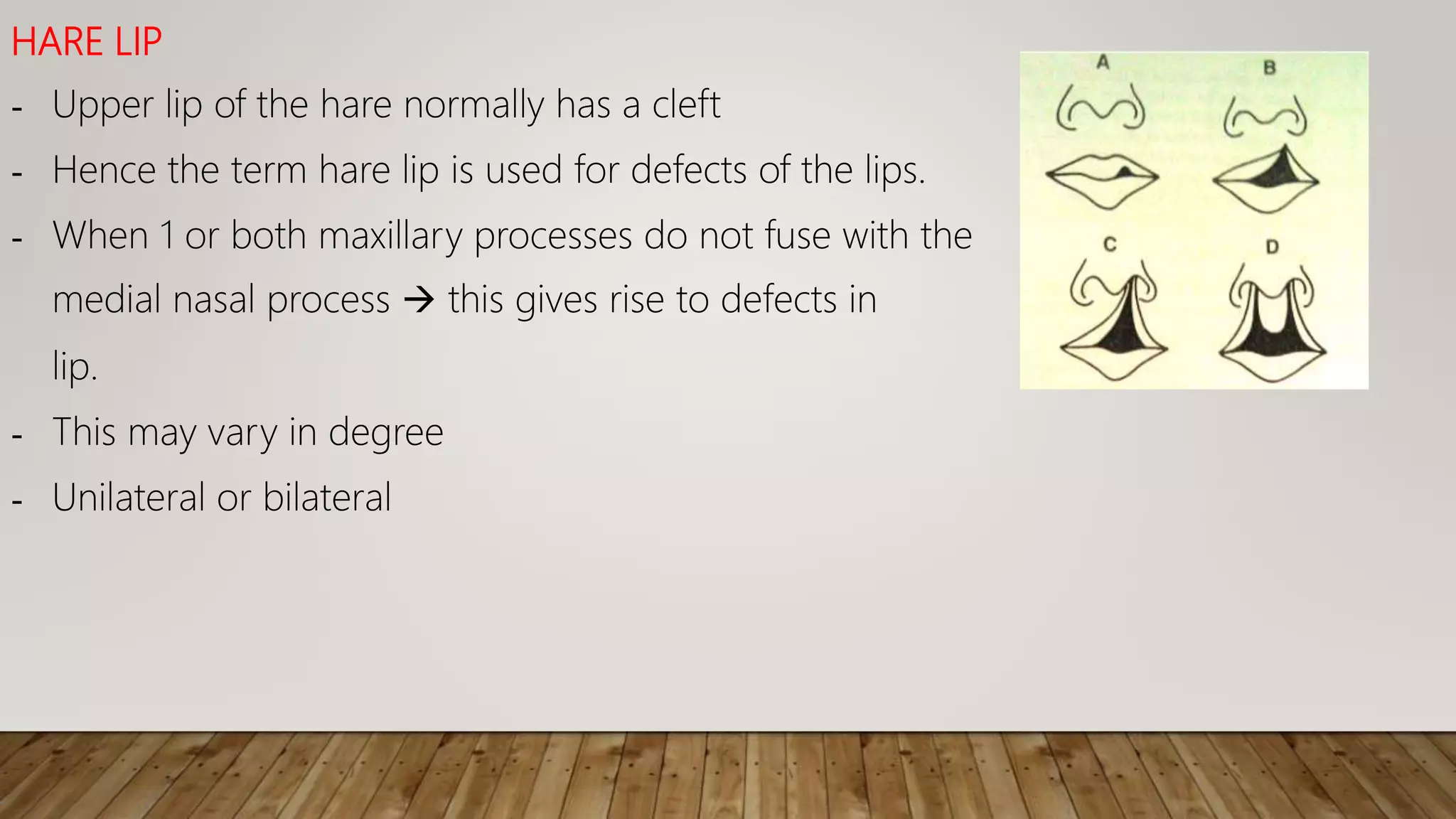 Developmental Disturbances of The Face | PPTX