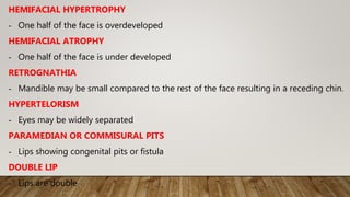 Developmental Disturbances of The Face | PPTX