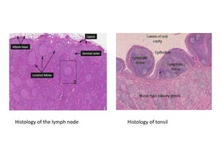 Developmental disturbance of Oral Lymphoid tissue | PPTX