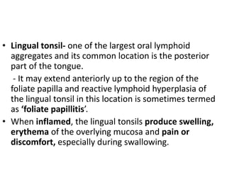 Developmental disturbance of Oral Lymphoid tissue | PPTX | Ear, Nose ...