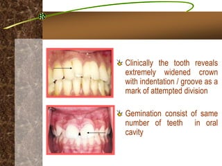 Developmental Disturbances.ppt