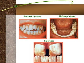 Mulberry Molars