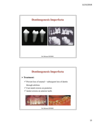 Developmental disturbances - Oral Pathology | PDF