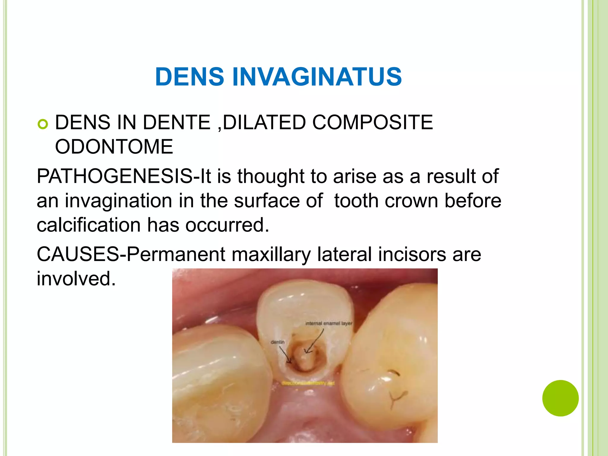 Developmental Disturbances in Shape of Tooth | PPTX