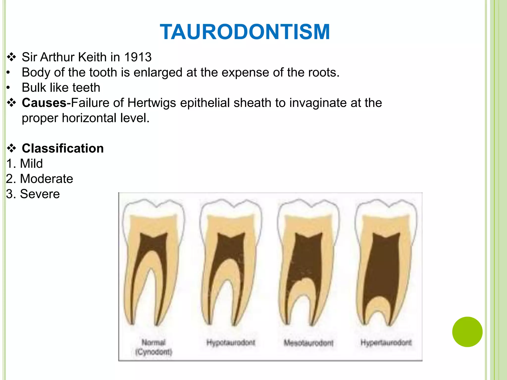 Developmental Disturbances in Shape of Tooth | PPTX