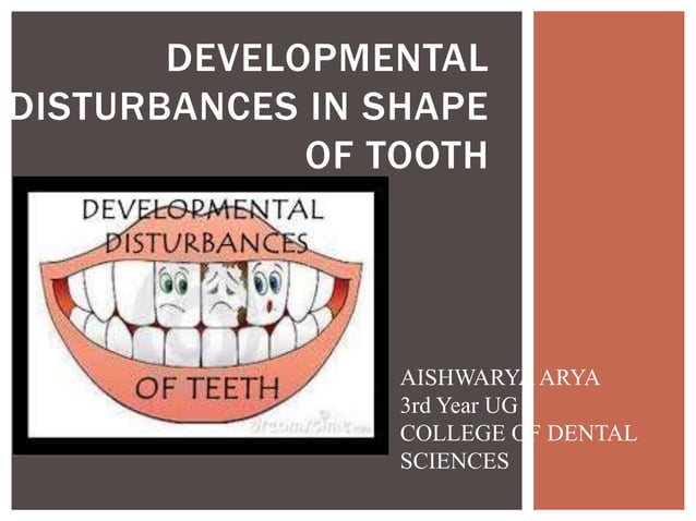 Developmental Disturbances in Shape of Tooth | PPTX | Dental Health ...