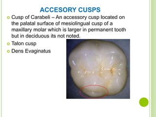 Developmental Disturbances in Shape of Tooth | PPTX