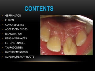 Developmental Disturbances in Shape of Tooth | PPTX
