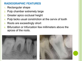 Developmental Disturbances in Shape of Tooth | PPTX