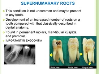 Developmental Disturbances in Shape of Tooth | PPTX