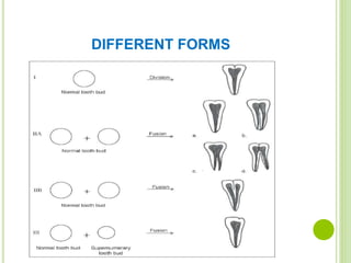 Developmental Disturbances in Shape of Tooth | PPTX