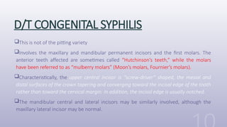 Developmental disturbances in structure - Enamel Hypoplasia.pptx