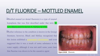 Developmental disturbances in structure - Enamel Hypoplasia.pptx