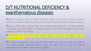 Developmental disturbances in structure - Enamel Hypoplasia.pptx